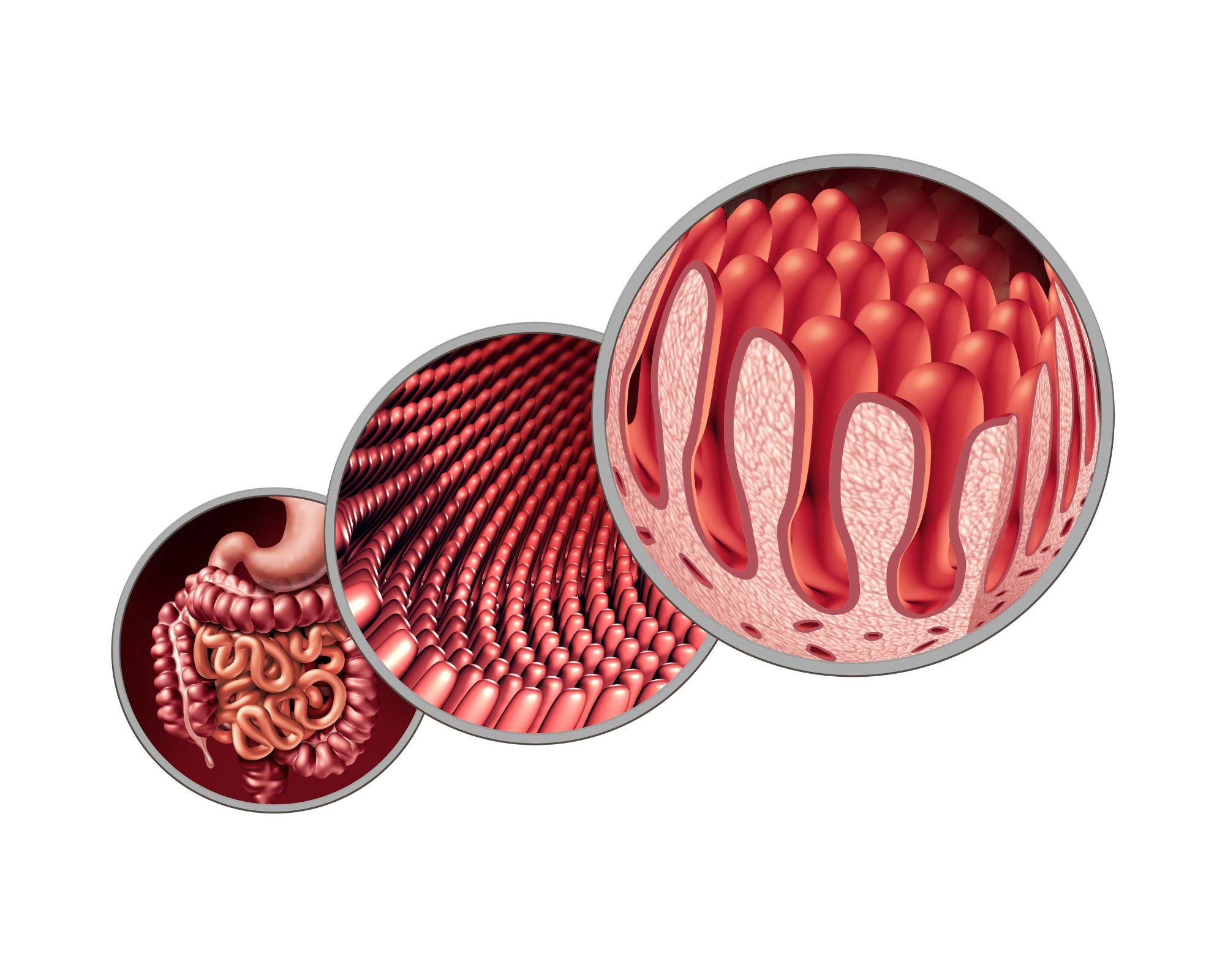 Gut health and the Ileocecal Valve (ICV) | SiLKinesiology